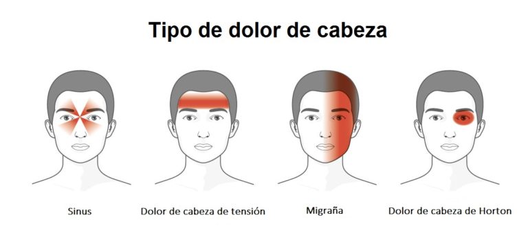 Dolor de cabeza o migrañas - NUEVA VIDA QUIROPRÁCTICA